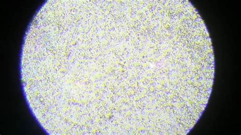 Sperm Cells Under The Microscope Stock Video Pond