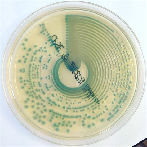 Microbiology On Instagram A Kesc Group Coliform Klebsiella