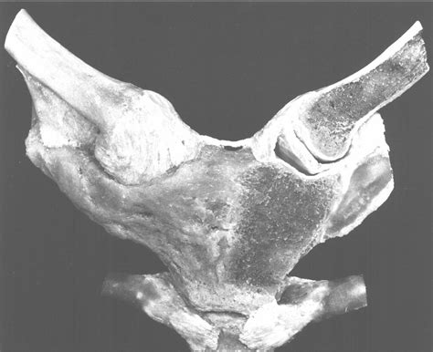 Sternoclavicular Joint Diagram Quizlet