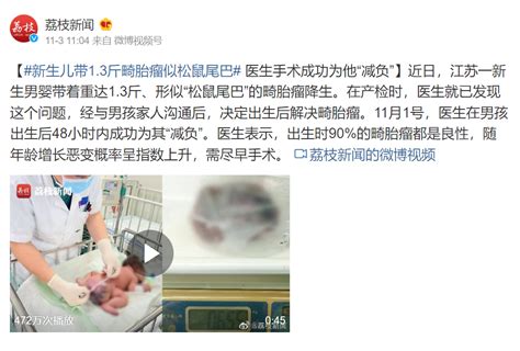 宝宝出生自带松鼠尾巴医生恶变之前尽早切除 医学界 助力医生临床决策和职业成长