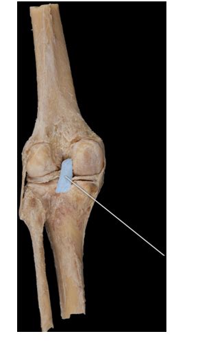 Solved Which Structure Is Highlighted O Lateral