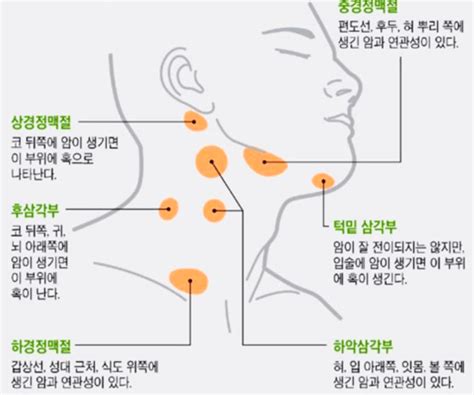 턱밑 정가운데 물렁한 부분 근육이 아픕니다 궁금할 땐 아하