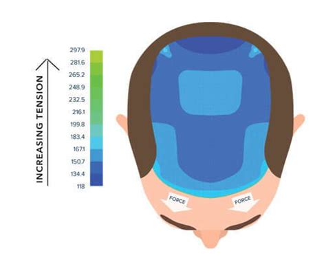 Scalp Tension And Scalp Massages For Hair Loss Hairguard