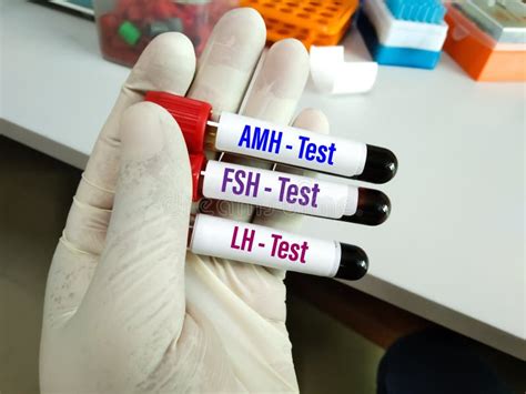 Blood Samples Tube With Sample For AMH FSH And LH Test Stock Photo Image Of Syphilis
