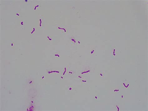 Enterococcus Faecium Identified In Csf Cytology From A Patient With