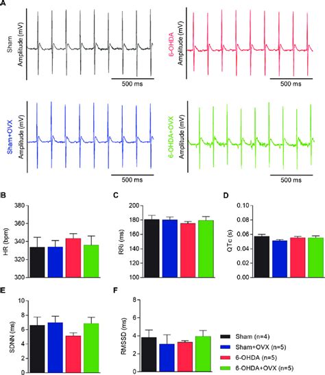 Heart Rate Variability Parameters Time Domain Analysis A Download Scientific Diagram