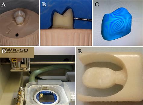 Figure 1 From Three Dimensional Finite Element Analysis Of Stress Distribution In A Tooth