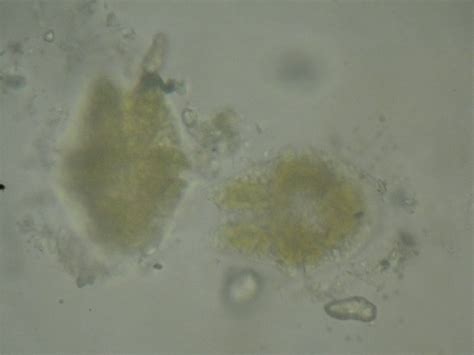 Phytoplankton Identification ResearchGate