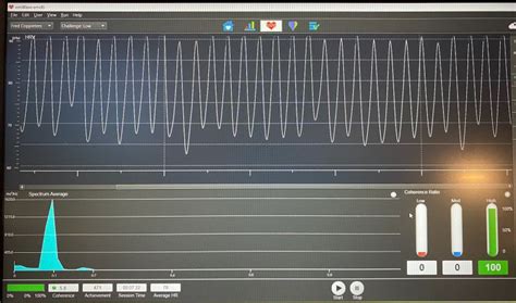 Heartcoherence Heartmath Biofeedback Frédéric Coppieters
