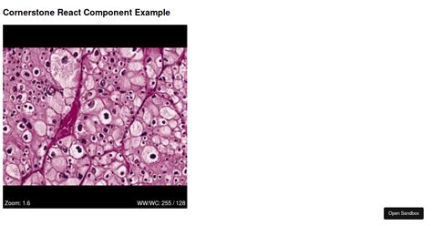 Cornerstone Core Examples Codesandbox