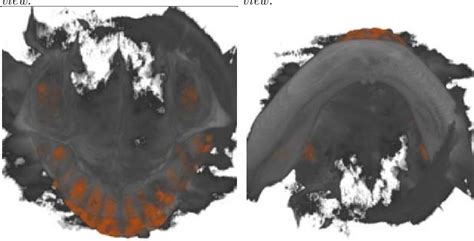 Figure 12 From Tooth Segmentation In 3d Cone Beam Ct Images Using Deep Convolutional Neural