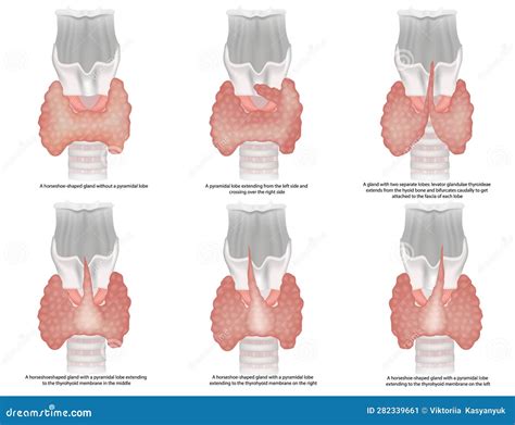 Illustration Of The Classification Of The Thyroid Gland Shapes The
