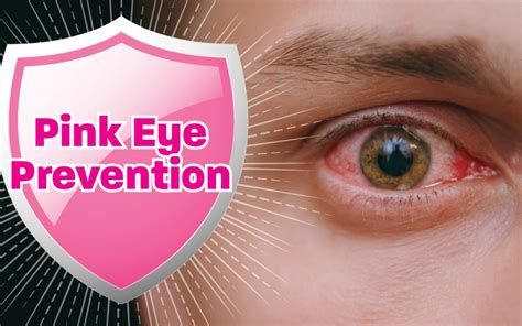 Tips For Pink Eye Prevention The Answers To Your Pink Eye Questions