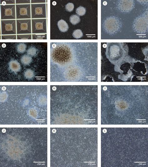 Neural Induction Of Hpscs Using The Embryoid Body Method