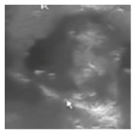 Comparison Of Image Enhancement Technique A Histogram Equalization Download Scientific