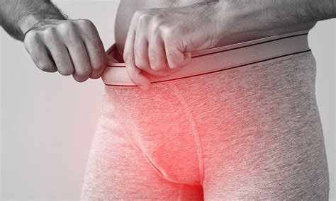 Male Yeast Infection