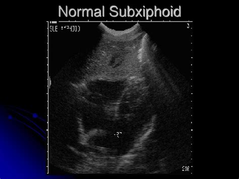 PPT FAST Exam PowerPoint Presentation ID