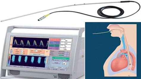 Cardiac Output Monitoring PPTX