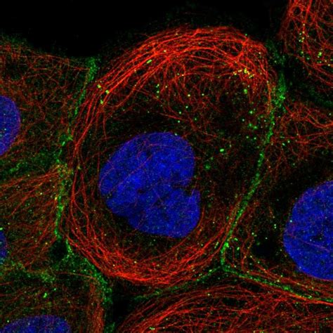 Rabbit Polyclonal Anti Pgs1 Antibody Buy For Research Highly Specific Rigorously Validated