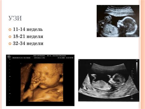 Методы обследования беременных и рожениц Акушерская терминология Диагностика беременности