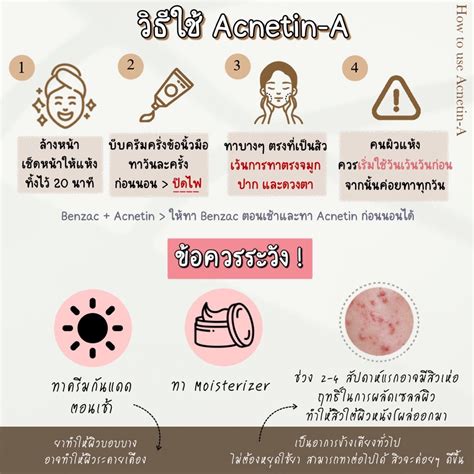 B Enz Ac เบนแซค 2 5 5 ขนาด 15g 60g พร้อมส่ง ลดสิวอุดตัน สิวอักเสบ Exp