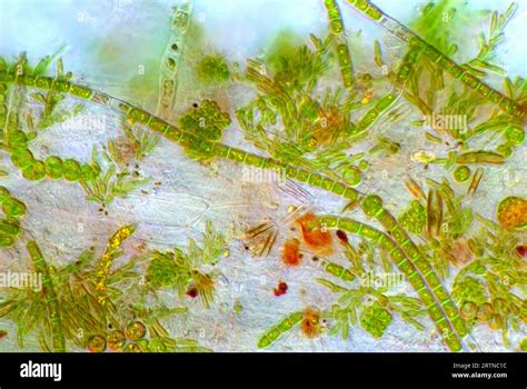 The Image Presents Various Tiny Algae Settled On Lemna Sp Root