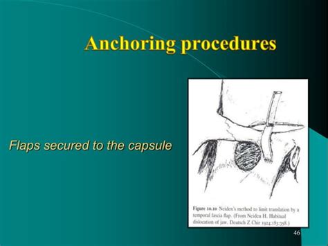 Tmj Dislocation And Its Management Pptx