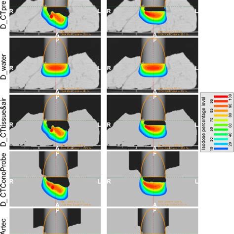 3d Dose Distributions Calculated Using The Monte Carlo Algorithm Axial Download Scientific