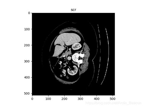 Python图像水平翻转python Matplotlib读取图片翻转 Csdn博客