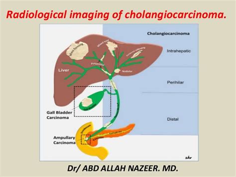 Presentation1 Pptx Radiological Imaging Of Cholangiocarcinoma