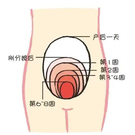 产后子宫怎样才算恢复好？得看这几个方面！检查剖宫产情况