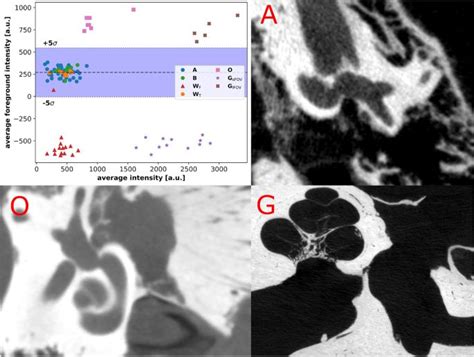 Towards Fully Automated Inner Ear Analysis With Deep Learning Based