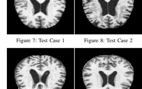 Figure 9 From Deep Learning Based Feature Fusion Model For Classifying