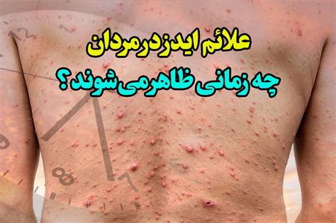 علائم ایدز در مردان چه زمانی ظاهر می‌شوند؟ وبلاگ فروشگاه رپید تست