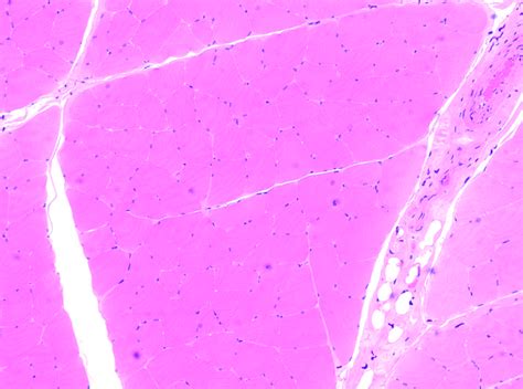 labex 5 transverse muscle fiber diagram quizlet
