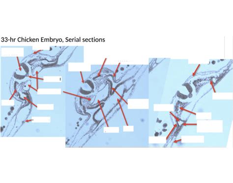 33 48 Hour Chicken Embryo Cross Section Quiz