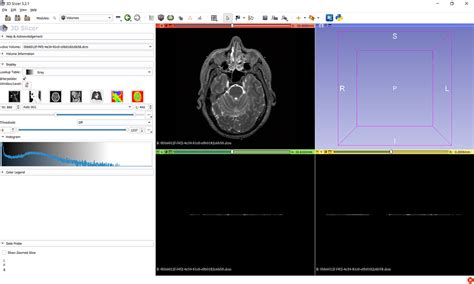 Loading Idc Converted Visible Human Dicom Images Into Slicer Support Imaging Data Commons