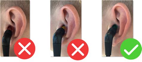 Tympanometry An Introduction Interacoustics