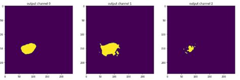 A Sample Of Segmentations From No L1 Model A The Four Mri Input