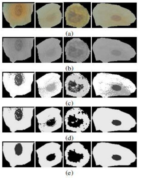 Samples Of Sputum Cells Through The Different Segmentation Stages A Download Scientific