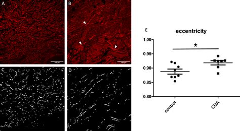 Quantitative Analysis Of Elastic Fiber Structure Based On Their Download Scientific Diagram