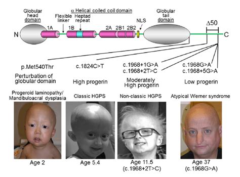 Progeria Cel Diagram Progeria Atherosclerosis And Clonal