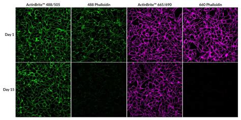 Biotium Launches New Phalloidin Conjugates With Extended F Actin