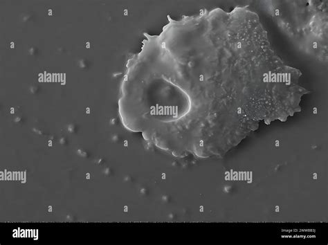 This Scanning Electron Microscope Sem Image Revealed Some Of The