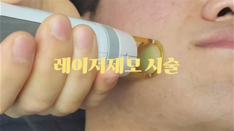 광주수염제모 젠틀맥스프로플러스 시술 절차 Youtube