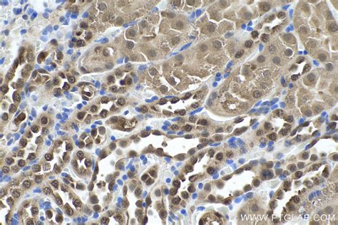 Pgk1 Antibody 68035 1 Pbs Proteintech