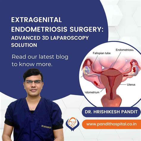 Best Ovarian Cyst Removal Doctors In India Dr Hrishikesh Pandit