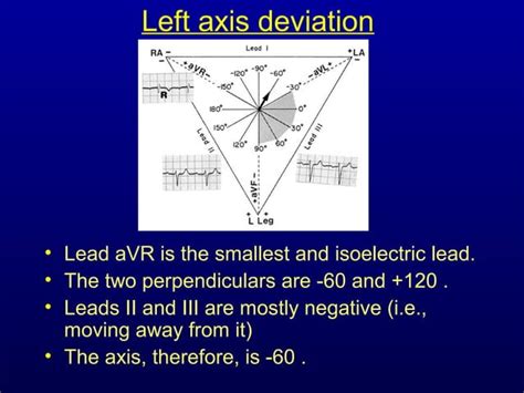 4th Part Ecg Basics Cardiac Axis Dr Salah Mabrouk Khallaf Ppt Heart And Cardiovascular