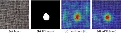 [논문 리뷰] Anomalouspatchcore Exploring The Use Of Anomalous Samples In Industrial Anomaly Detection
