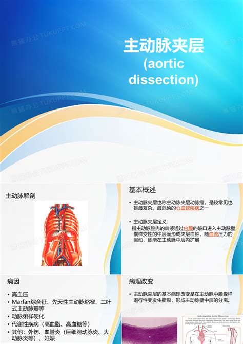 主动脉夹层PPT模板下载 编号qmovzrog 熊猫办公